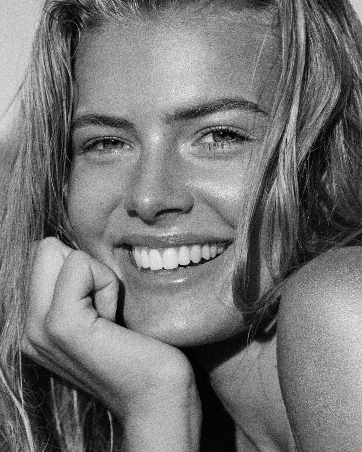 Frederique Brons - Skins Model Management